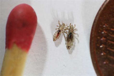 Head Lice And Nits The Symptoms And Treatment Netmums