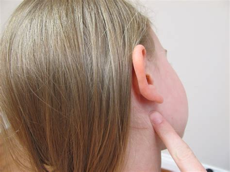 Natural Herbal Remedies For Ear Infections Ear Infection Remedy Ear
