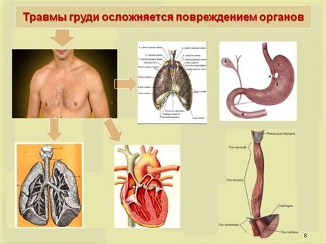 Первая медицинская помощь при травмах груди живота и области таза
