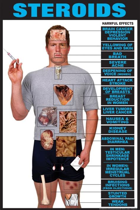 Infographic On Steroids Artofit