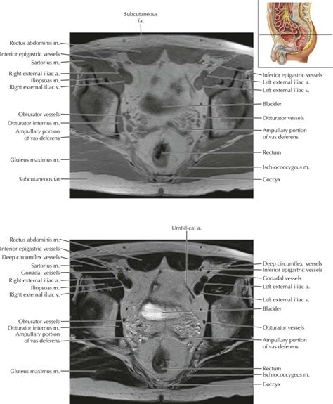 Male Pelvis Radiology Key