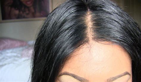 How To Bleach Your Knots To Perfection Belair Beauty Club