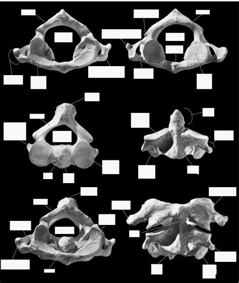 Atlas Axis Vertebrae Diagram Quizlet