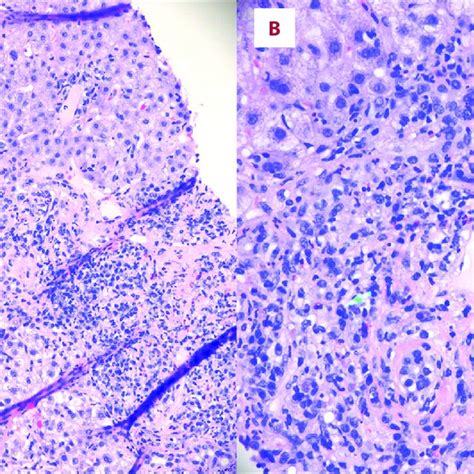 Hepatic Parenchyma On Trichrome Stained Section At 400× Magnifications Download Scientific
