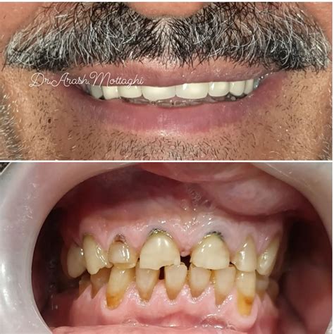‎دندانپزشک💎قزوین💎بورد تخصصی‎ Drarashmottaghi • Instagram Photos