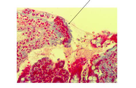 Lab Final Diagram Quizlet Lab Final Diagram Quizlet