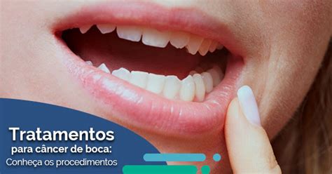 3 tratamentos para câncer de boca conheça os procedimentos