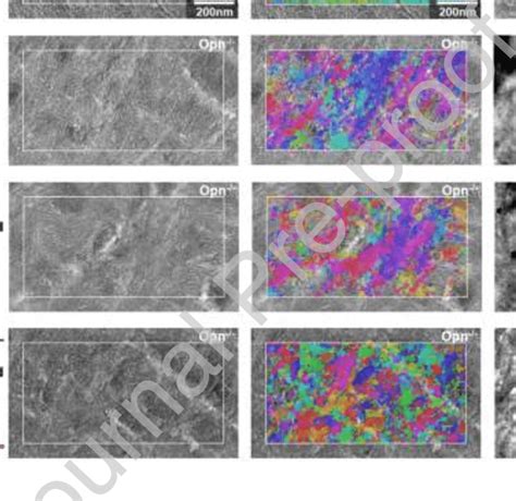 Adjacent Sections Of Mineralized And Demineralized Bone Showing The Download Scientific