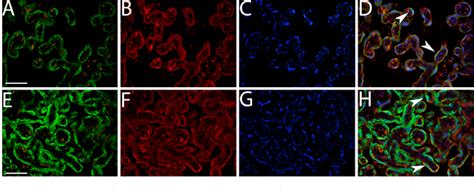 Figure 4 From Expression Of Imp3 And Lin28a Rna Binding Proteins In