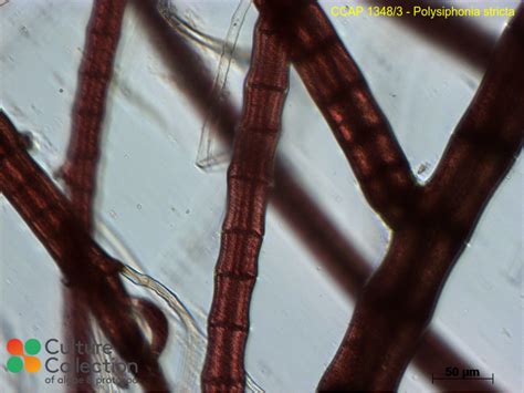 Polysiphonia Under Microscope