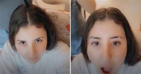 Agonising Scalp Popping Tiktok Trend Slammed As Dangerous By Doctor