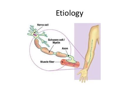 Charcot Marie Tooth Disease