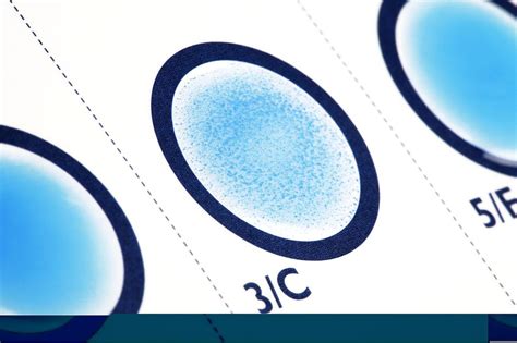 Streptococcus Grouping Test Photograph By Science Photo Library Fine Art America