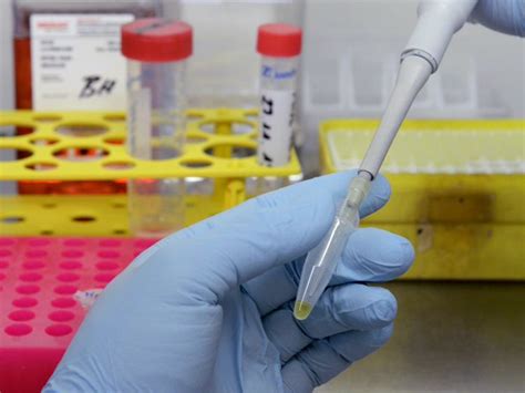 Video Analysis Of Cell Migration Within A Three Dimensional Collagen Matrix