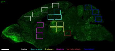 Brain Regions Selected For Cell Type Quantification Depicted On Brain