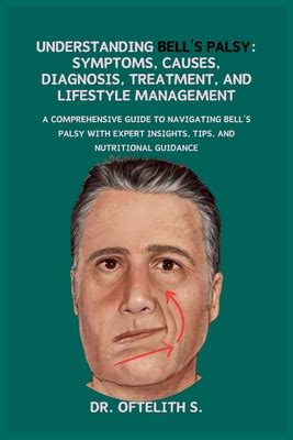 Understanding Bell S Palsy Symptoms Causes Diagnosis Treatment And
