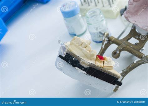Dental Technician Unscrew The Hybrid Ceramics The Milling Machine