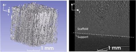 Investigating The Internal Microstructure Of Highly Porous Ceramic Scaffolds For The
