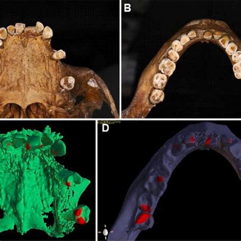 A Odontogram With Fdi World Dental Federation Numbering System B Download Scientific Diagram
