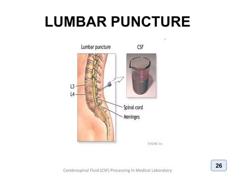 Csf Processing In Medical Laboratory 01 Pdf