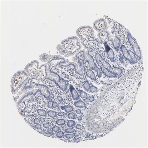 Tissue Expression Of Kdr Staining In Duodenum The Human Protein Atlas