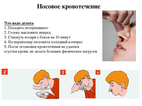 Кровотечение из носа. причины и помощь при носовом кровотечении.!