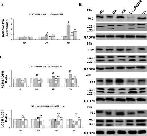 Ursolic Acid Attenuated Hg Induced Rat Mesangial Cell Autophagy