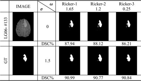 Segmentation Results With Original Images Download Scientific Diagram