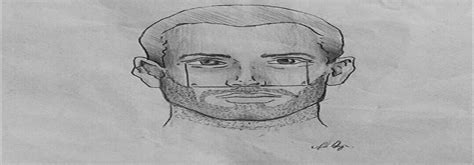 Anatomical Landmarks Of The Beard Region Dermatologic Surgery
