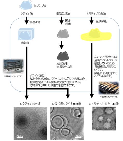 クライオ電子顕微鏡を用いたエクソソーム等の観察受託サービス テラベース社エクソソーム等の微細構造を位相差電子顕微鏡を用いて観察する受託