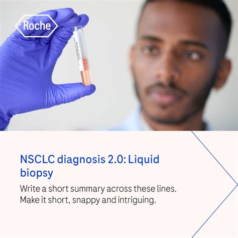 Nsclc Diagnosis 2 0 A Strategic View Of Liquid Biopsy Lableaders