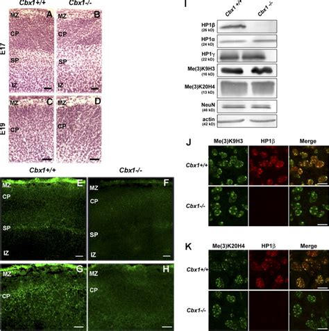 Immunohistochemical And Western Blot Analysis Of Cbx1−− Brains Ad