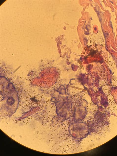 Mucus Unknown Objects Adjacent To Chicken Duodenum R Histology