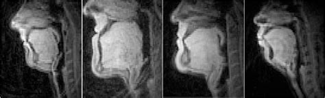 Figure 1 From Speaker Verification Based On The Fusion Of Speech Acoustics And Inverted
