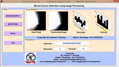Matlab Code For Breast Cancer Detection Using Image Processing Matlab Project Codes
