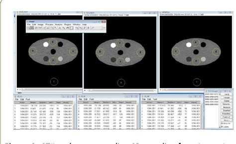 Figure 2 From Computed Tomography Ct Automatic Exposure Controls Aec