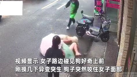 女子带小孩蹲下摸陌生狗，惨遭其撕咬面部，当场倒地不起痛苦哀嚎