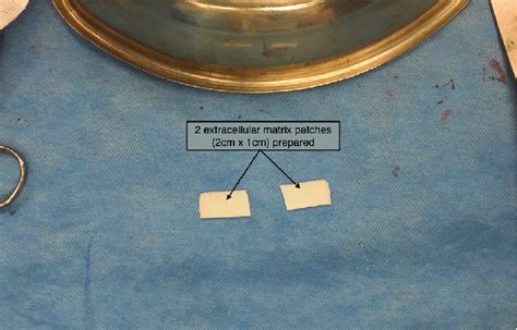Two Patches Of Ecm 2x1cm Are Prepared Download Scientific Diagram