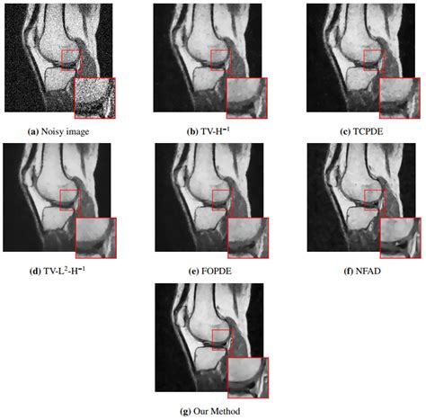 an improved coupled pde system applied to the inverse image denoising problem
