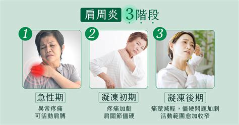 【肩周炎】一文認識五十肩原因、症狀、舒緩運動及治療（2023年專家意見）