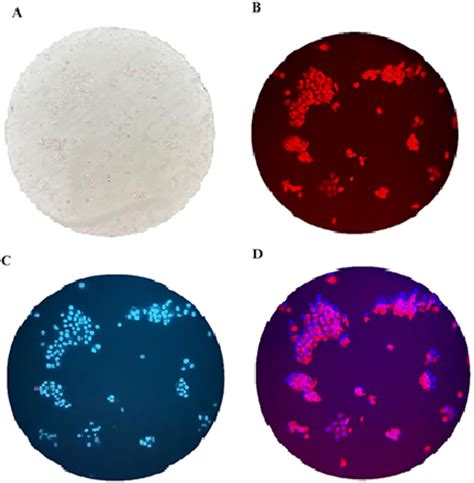 A Coumarin Based Fluorescent Chemosensor As A Sn Indicator And A