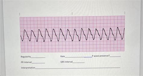 Solved Regularity Rate P Wave Presence PR Interval QRS Chegg Com