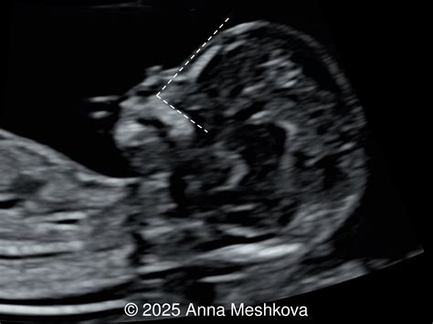 Case Of The Week 625