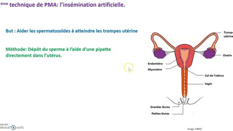La Procréation Médicalement Assistée Youtube