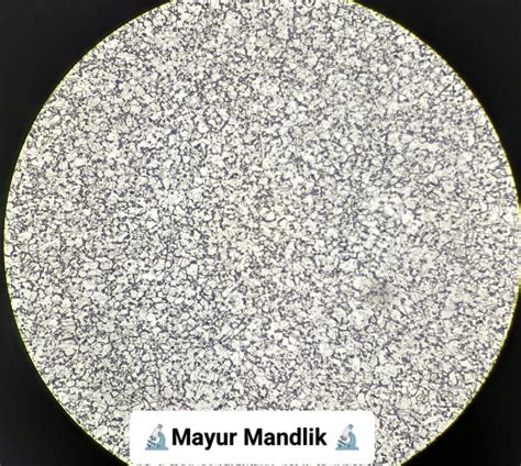 Mayur Mandlik On Linkedin Ss304 Grade Astm A262 Practice A Identify