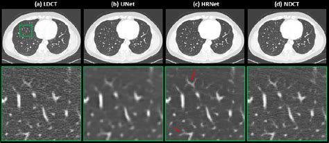 Figure 4 From Deep High Resolution Network For Low Dose X Ray Ct Denoising Semantic Scholar