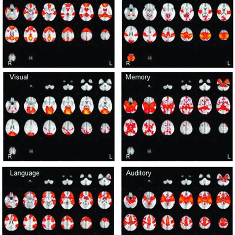 Resting State Connectivity Patterns Of Resting State Networks Across