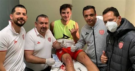 Unai Bilbao Fue Suturado Con 12 Puntos Y No Hay Fecha De Su Regreso