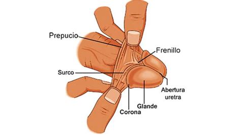 Desgarro De Frenillo Del Pene Una Lesión Común Entre Los Hombres
