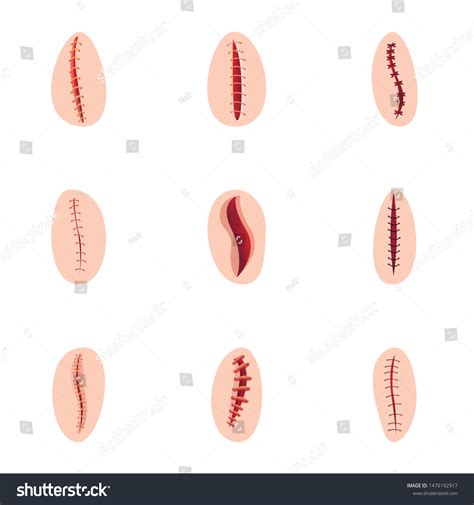 Surgical Suture Icon Set Cartoon Set Stock Vector Royalty Free